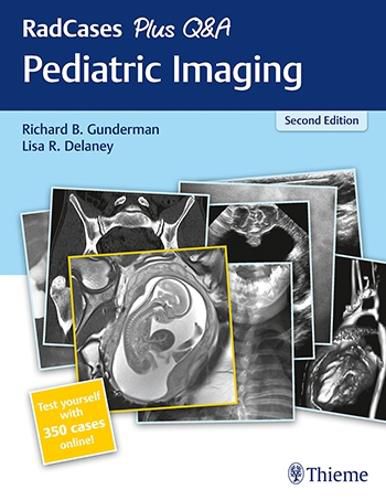 RadCases Plus Q&A Pediatric Imaging, Richard B. Gunderman,Lisa Delaney ...