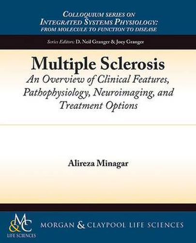 Multiple Sclerosis: An Overview of Clinical Features, Pathophysiology, Neuroimaging, and ...